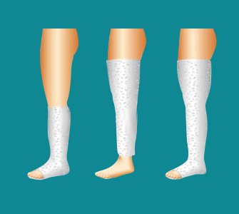 Trauma & Injuries Doctor in Gurgaon | Young Bones Clinic