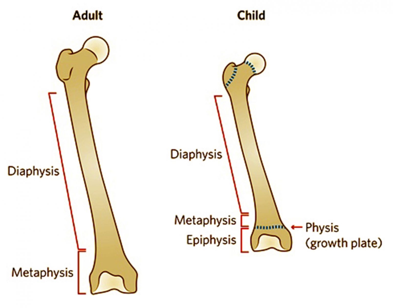How Are Children s Bones Different From Adult s Bones Young Bones Clinic